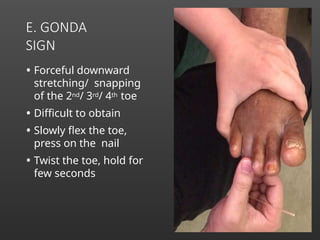 Plantar Reflexes and babinski sign for neurological patients | PPTX