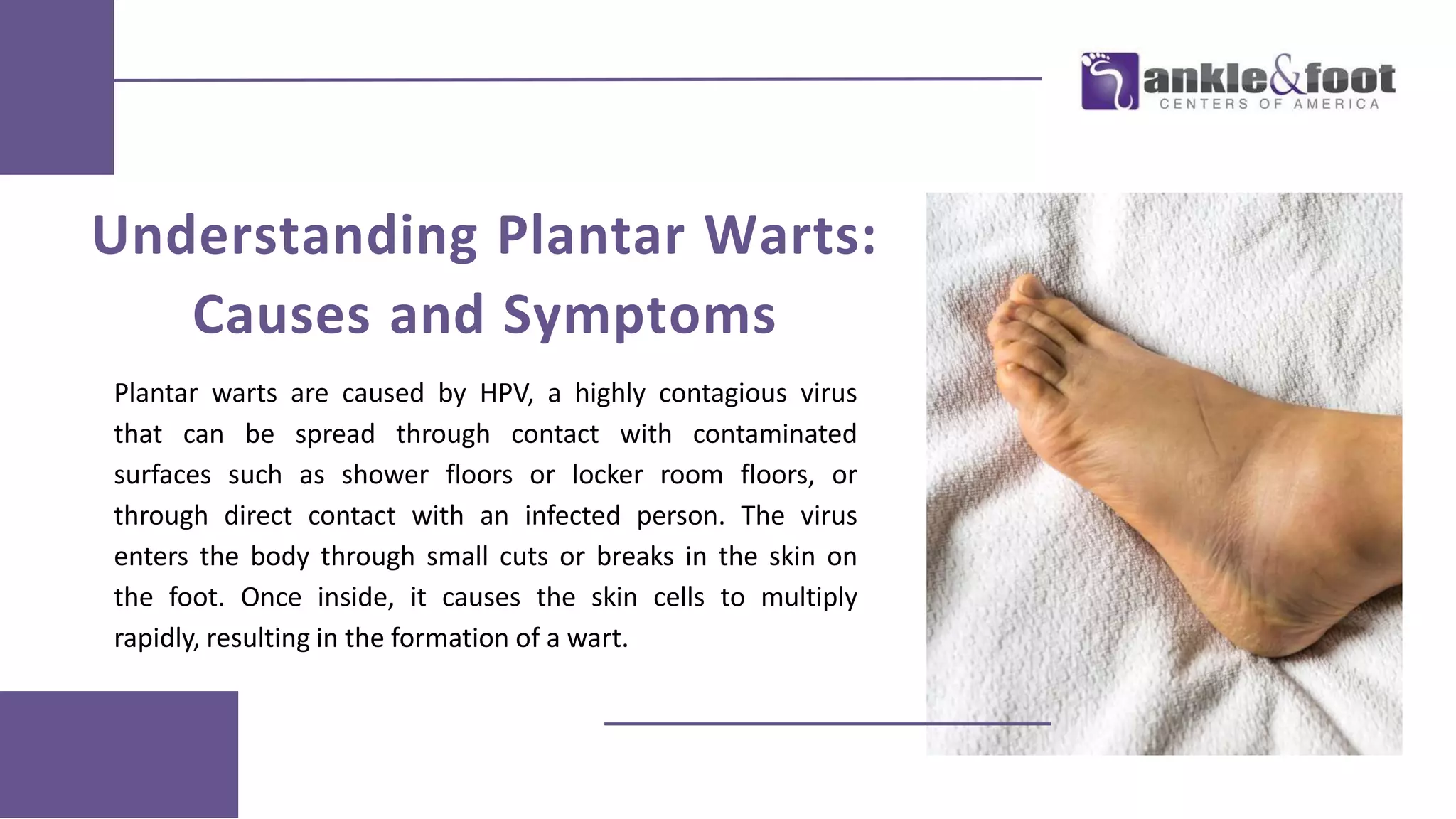 Plantar Wart Treatment | PPTX