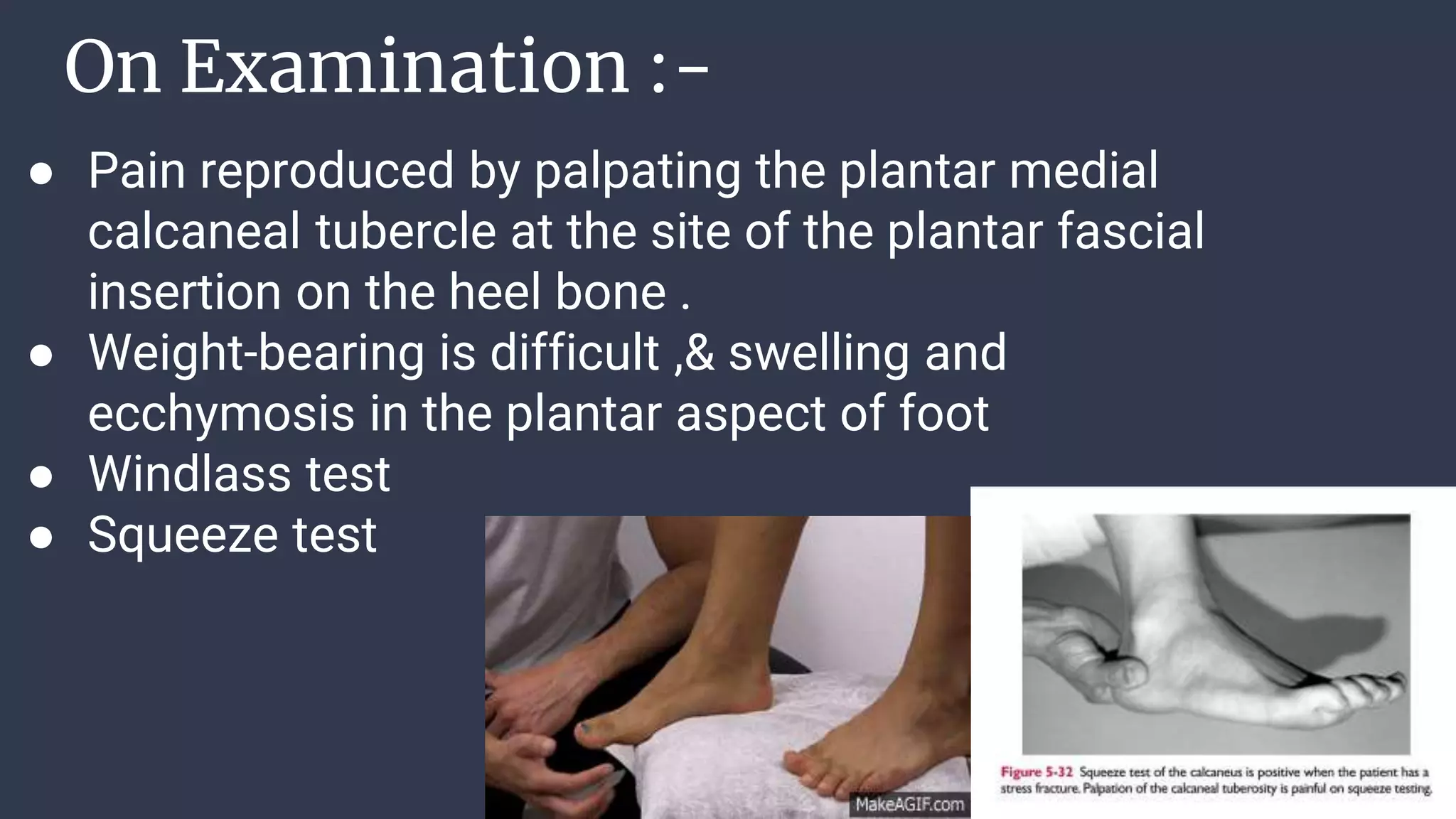 Planter fasciatis .pptx