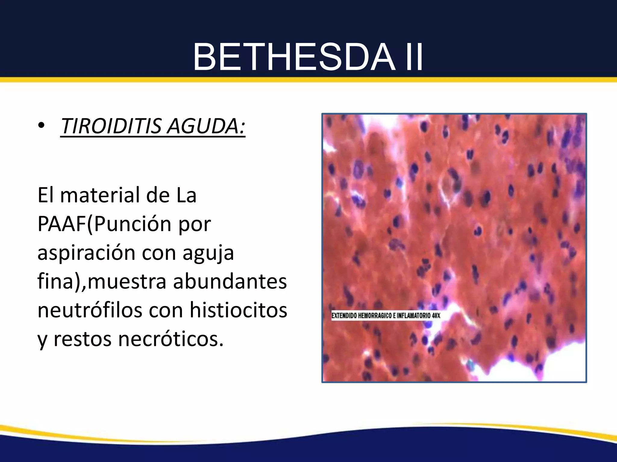 Bethesda II de Tiroides | PPTX