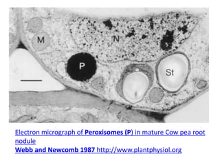 Peroxisome Micrograph