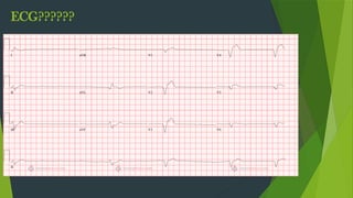 Vegetative Poisons - plant poisoining final | PPT