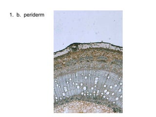 Plant Tissues , typesand anatomy (1).ppt
