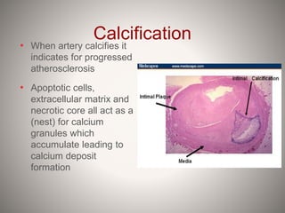 acute coronary syndrome | PPTX