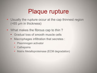 acute coronary syndrome | PPT