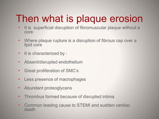 acute coronary syndrome | PPTX