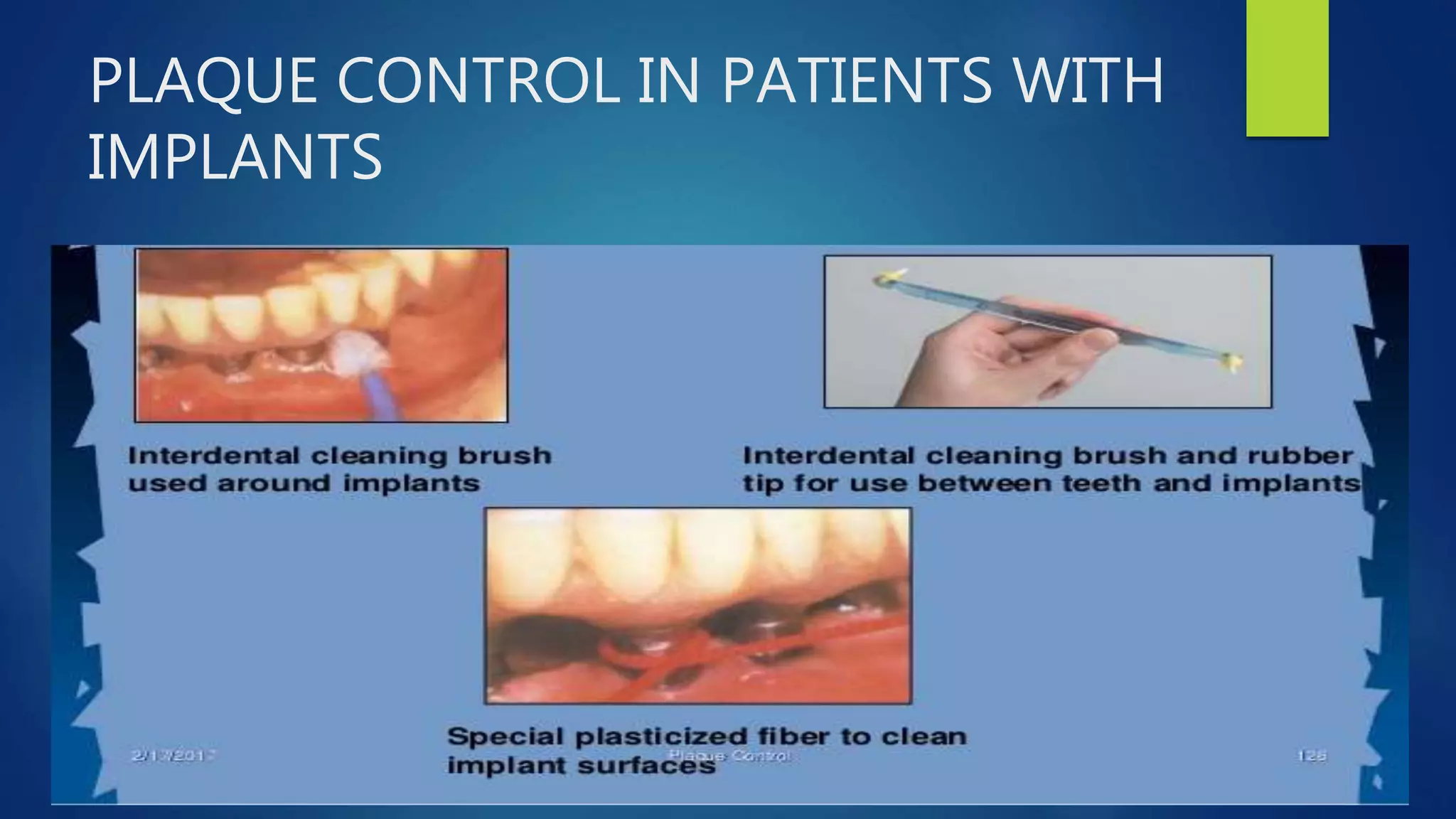 mechanisms of Plaque control | PPTX