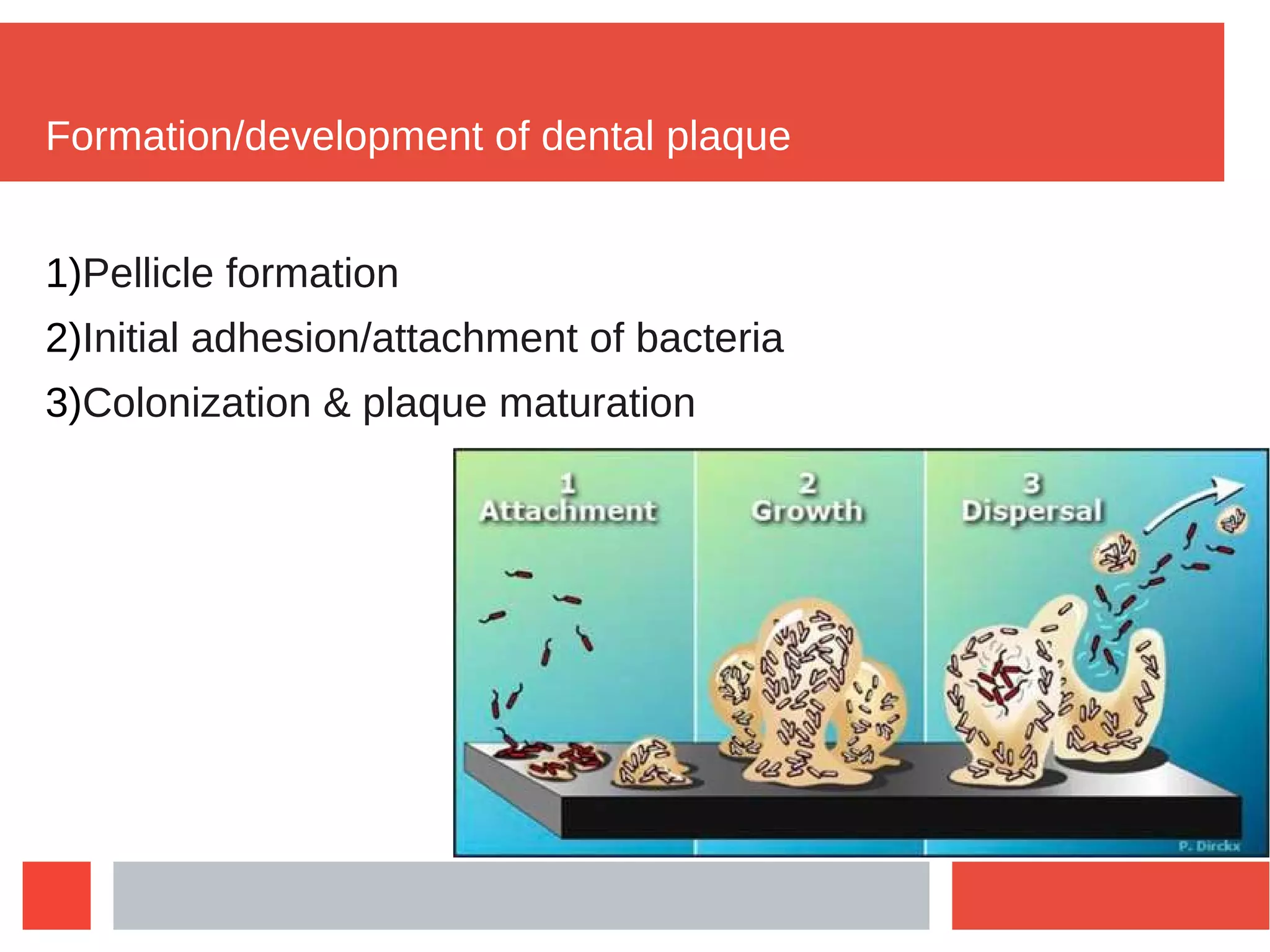 Dental Plaque | ODP