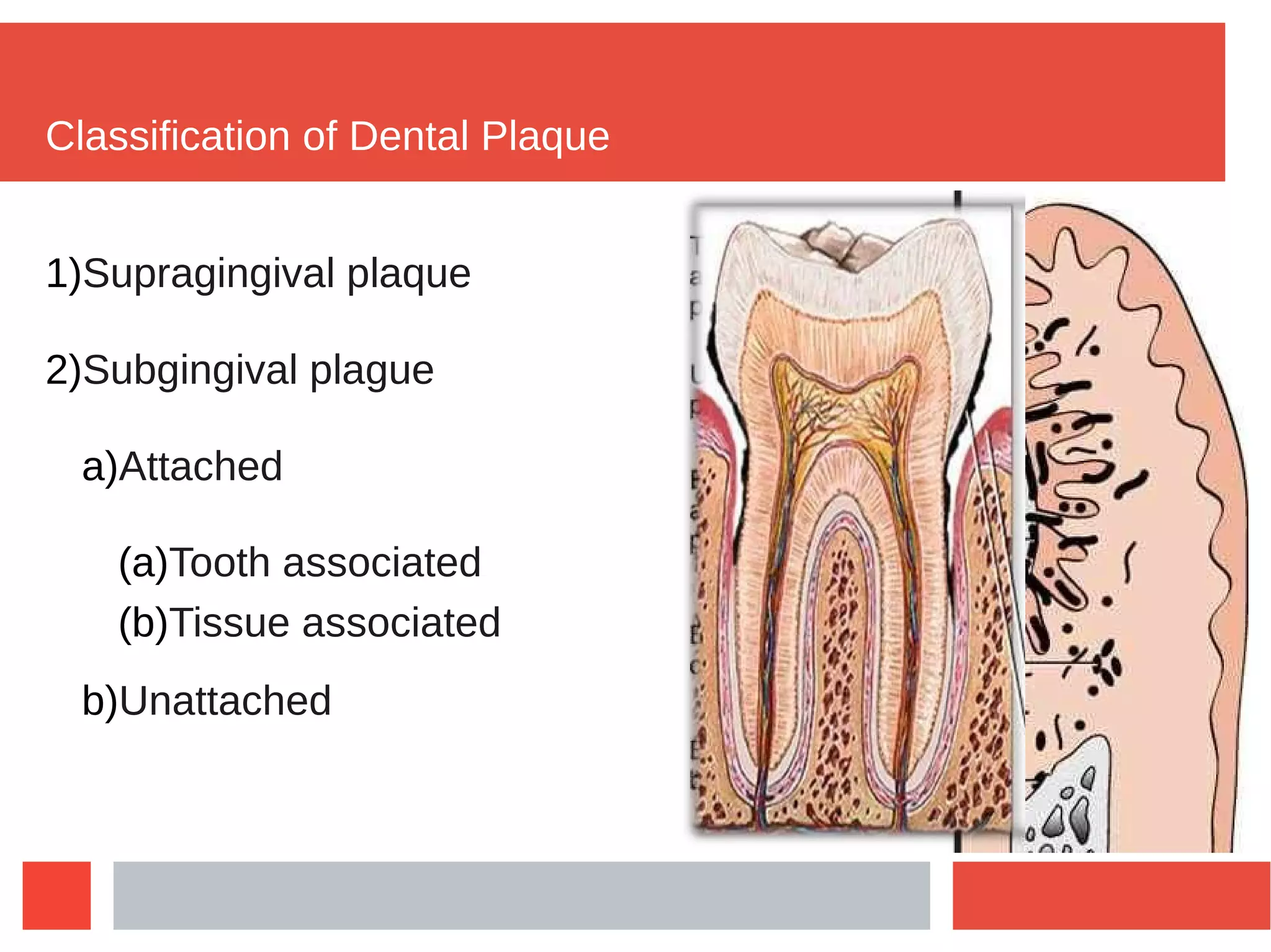 Dental Plaque | ODP