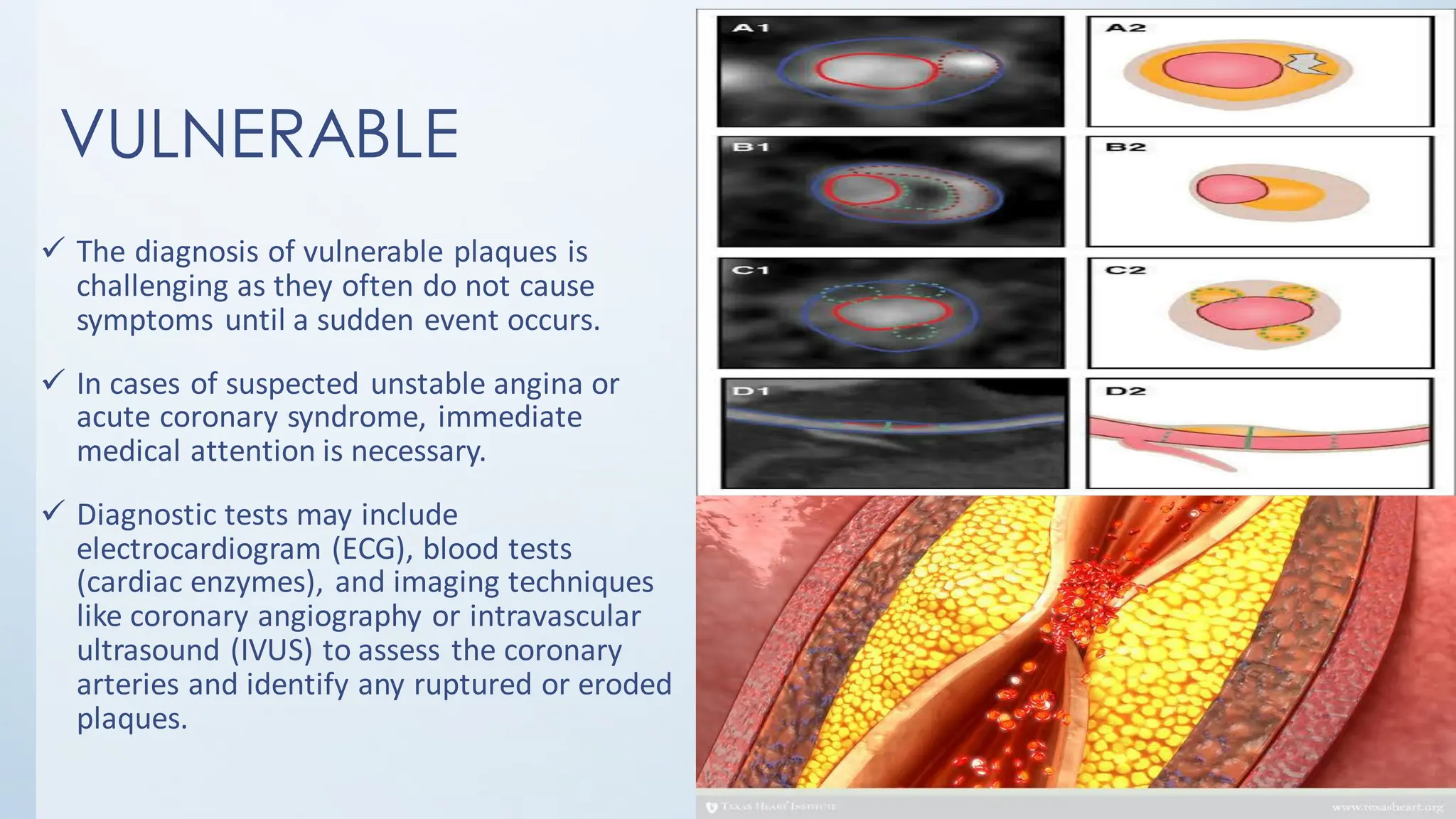 TYPES OF CORONARY PLAQUES SLIDESHARE PRESENTATION | PDF