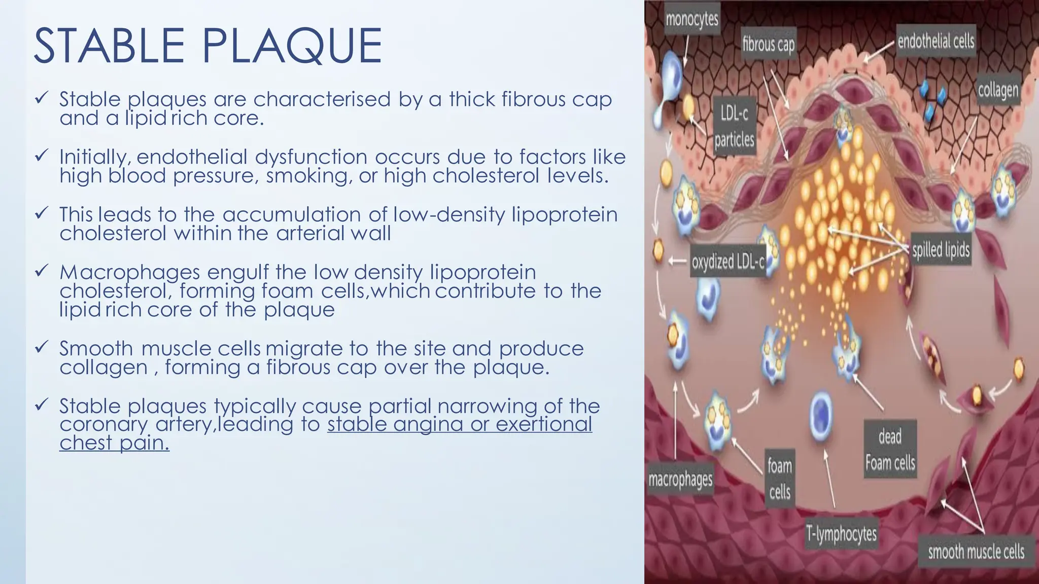 TYPES OF CORONARY PLAQUES SLIDESHARE PRESENTATION | PDF