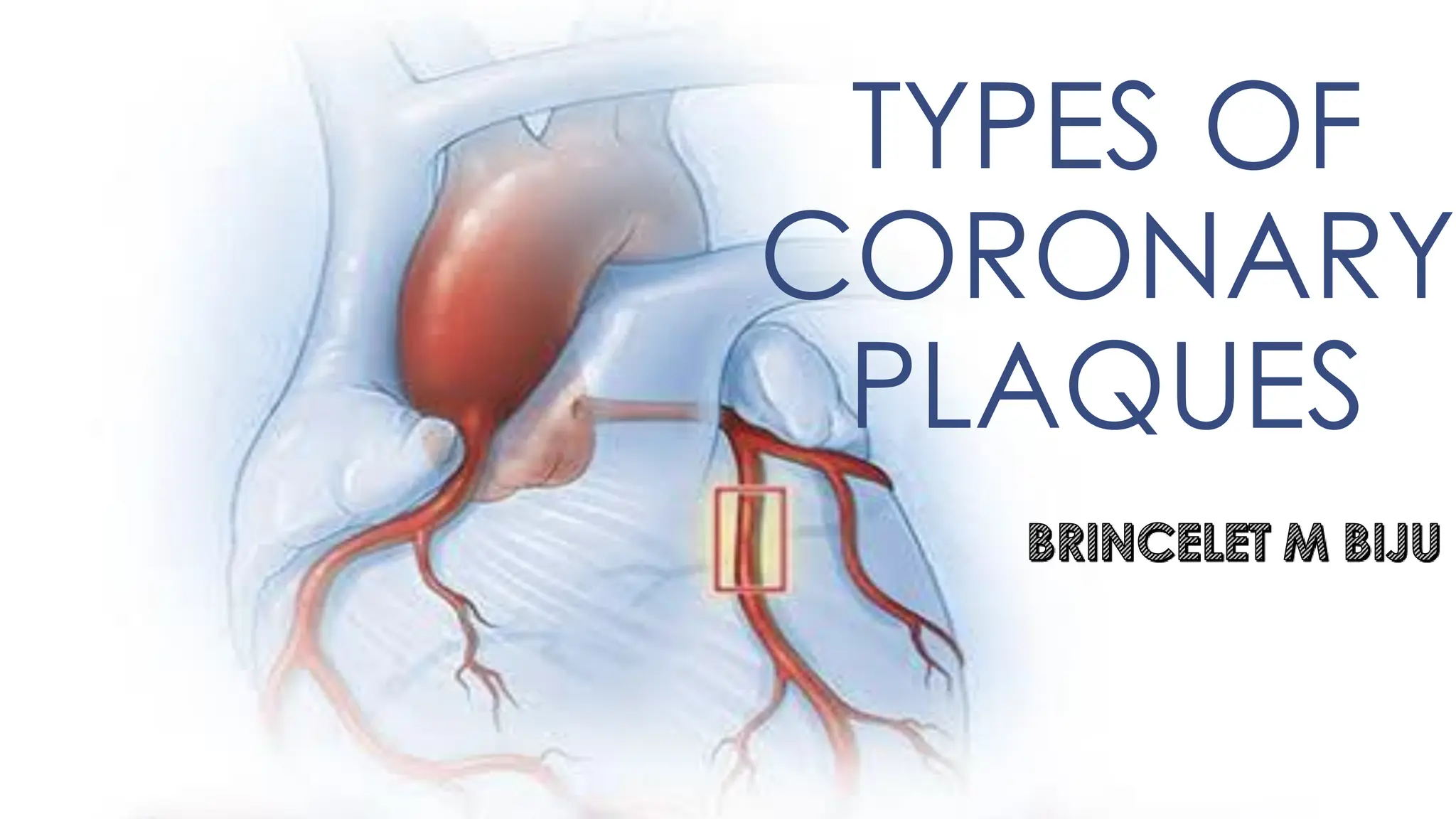 TYPES OF CORONARY PLAQUES SLIDESHARE PRESENTATION | PPT
