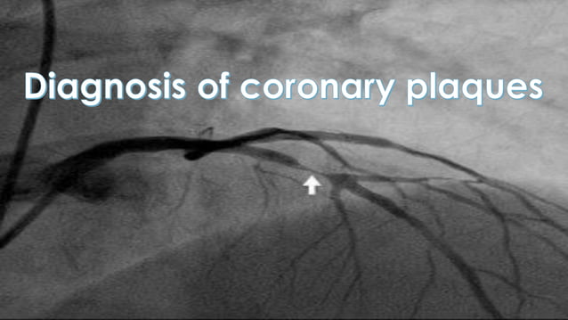 TYPES OF CORONARY PLAQUES SLIDESHARE PRESENTATION | PDF