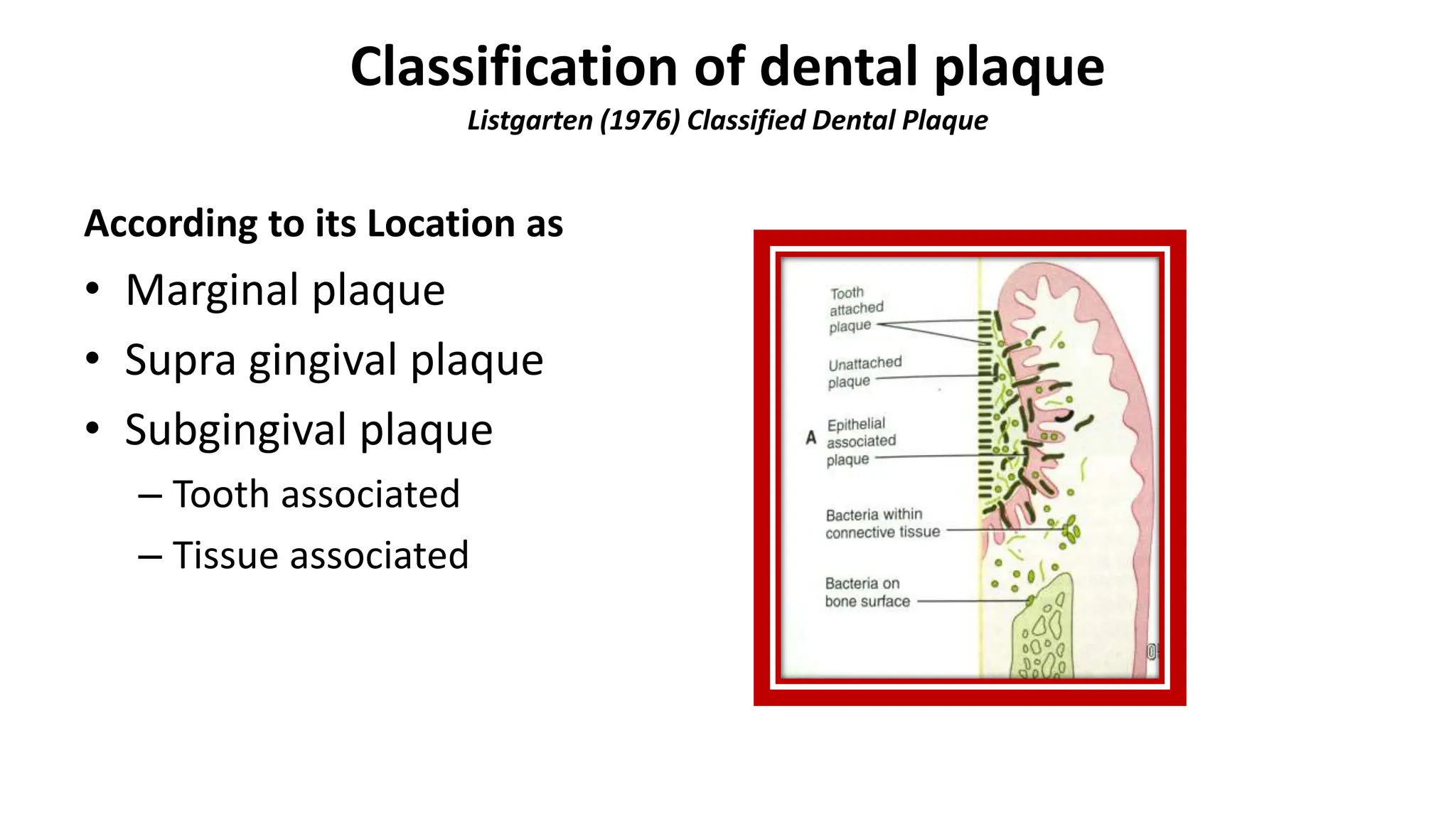 plaque as a biofilm power point in periodontics | PPTX