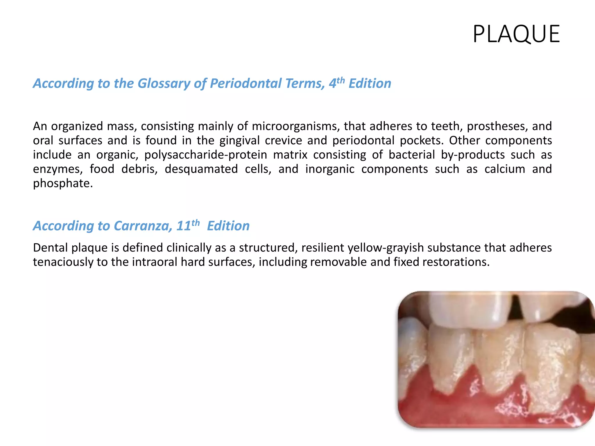 Plaque as a Biofilm | PPTX
