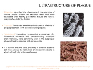 Plaque as a Biofilm | PPTX