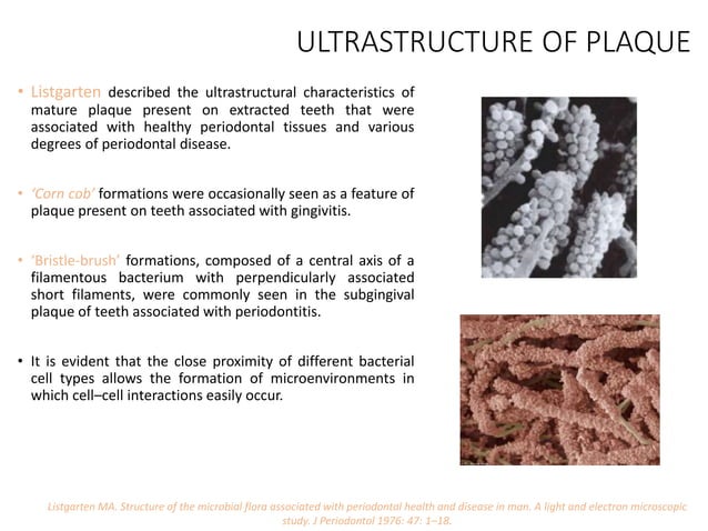 Plaque as a Biofilm | PPTX | Dental Health | Diseases and Conditions