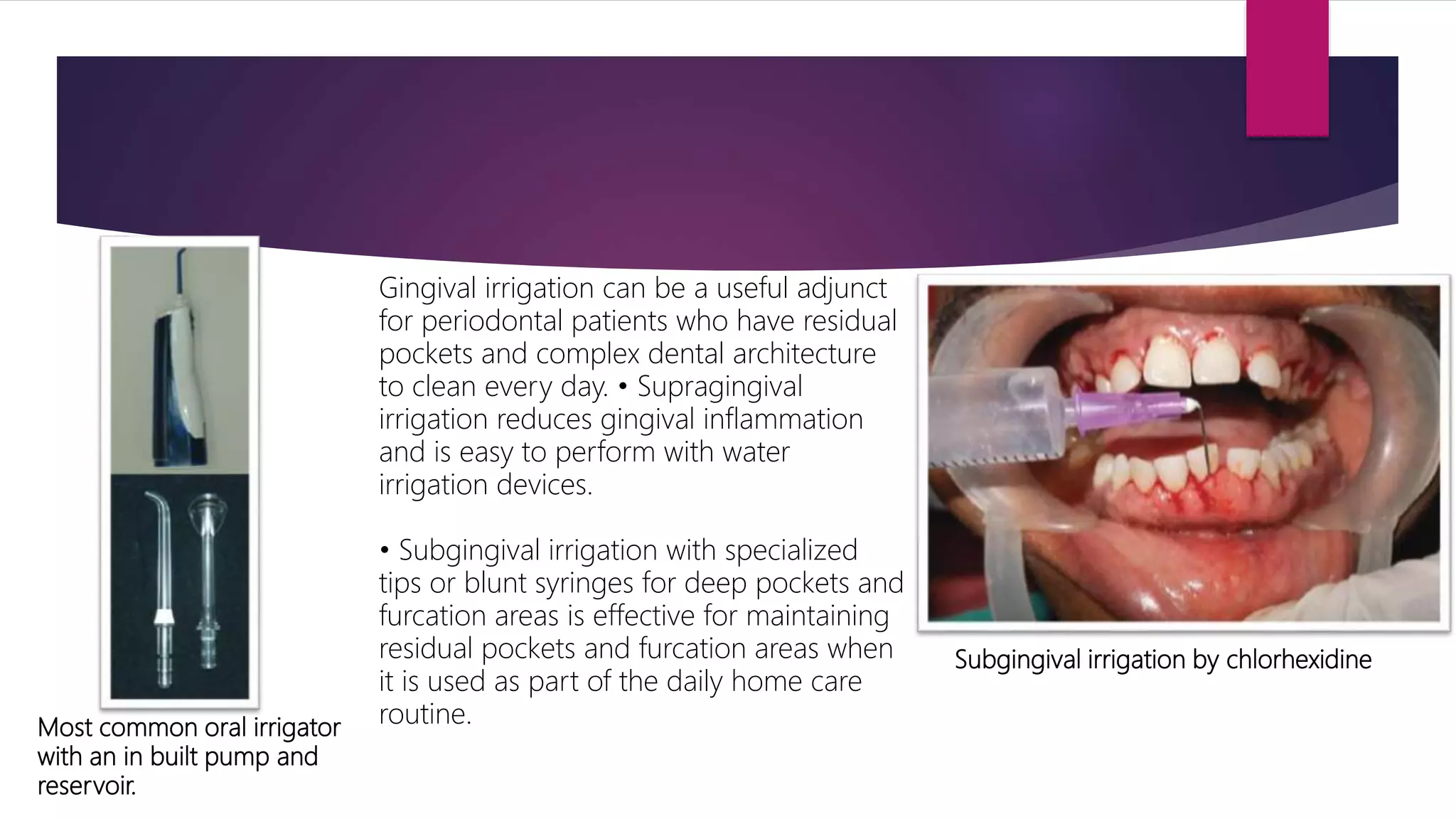 PLAQUE BIOFILM CONTROL.pptx