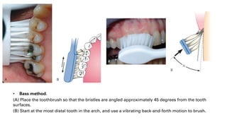 Plaque Biofilm Control for the Periodontal Patient(4).pdf