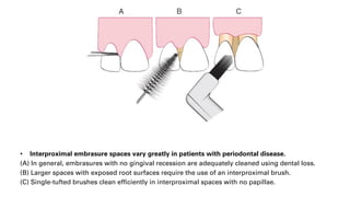 Plaque Biofilm Control for the Periodontal Patient(4).pdf