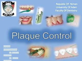 Plaque control | PPTX