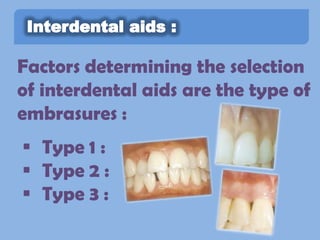 Plaque control | PPTX