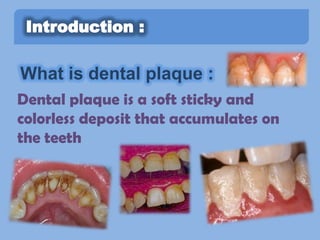 Plaque control | PPTX