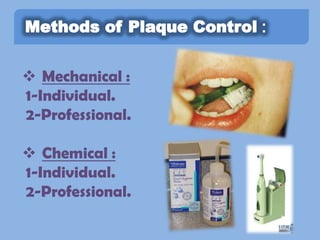 Plaque control | PPTX
