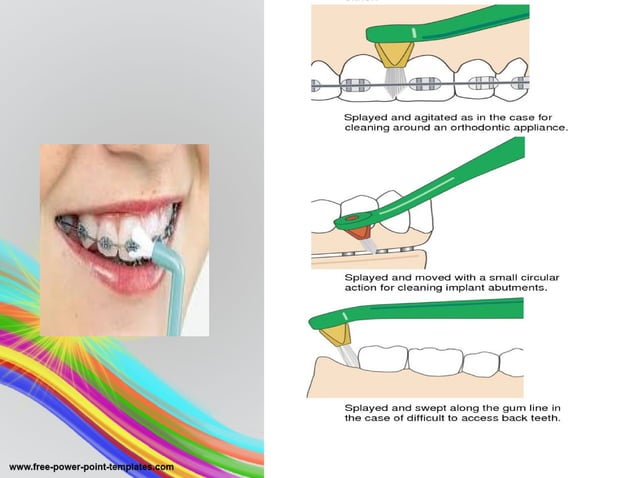 Plaque control | PPT | Dental Health | Diseases and Conditions
