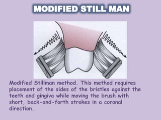 Plaque control | PPTX
