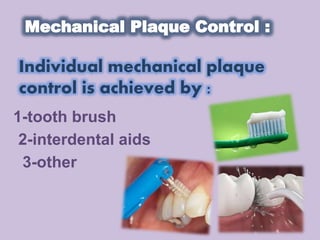 Plaque control | PPTX