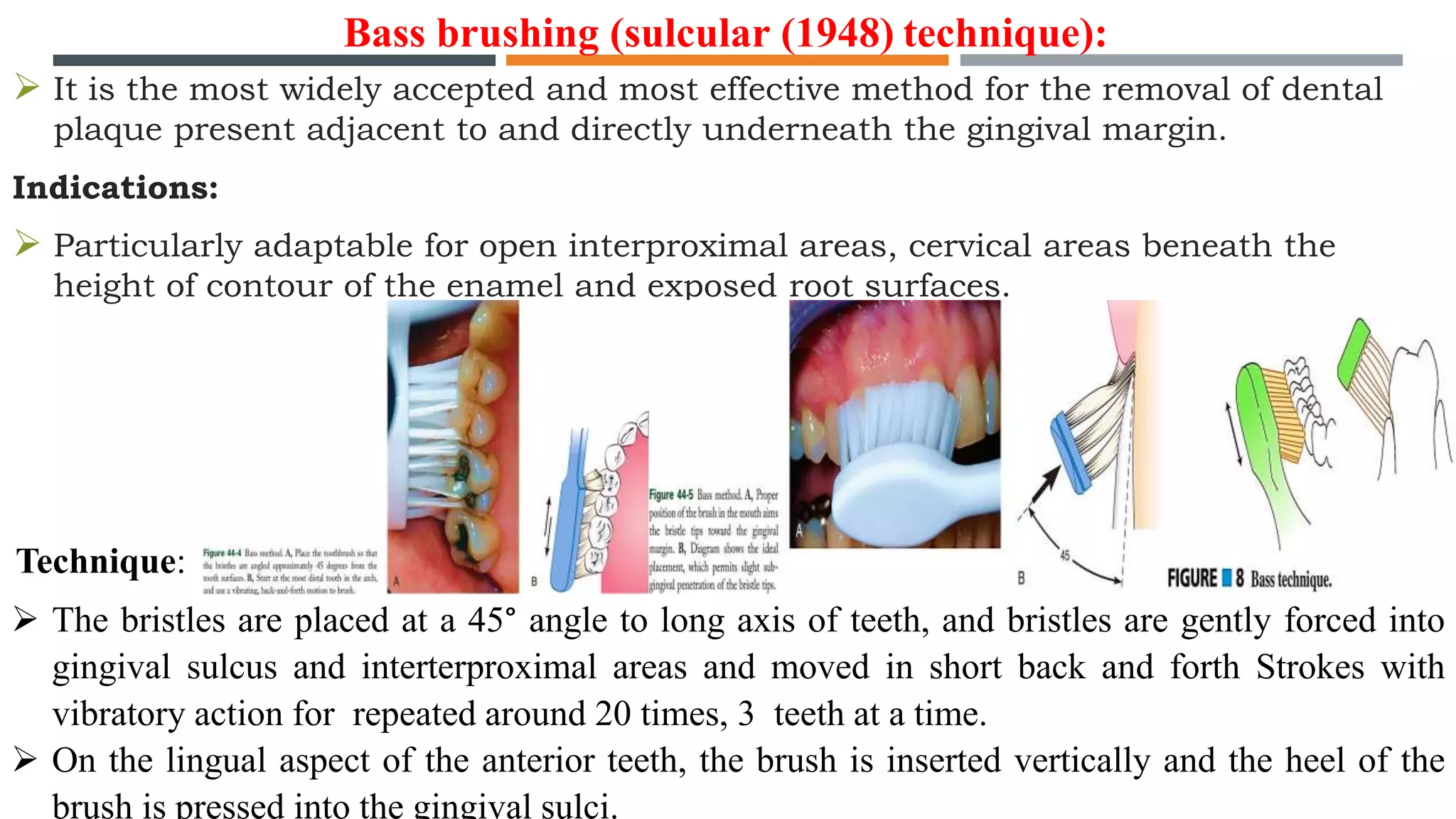 Plaque control | PPTX