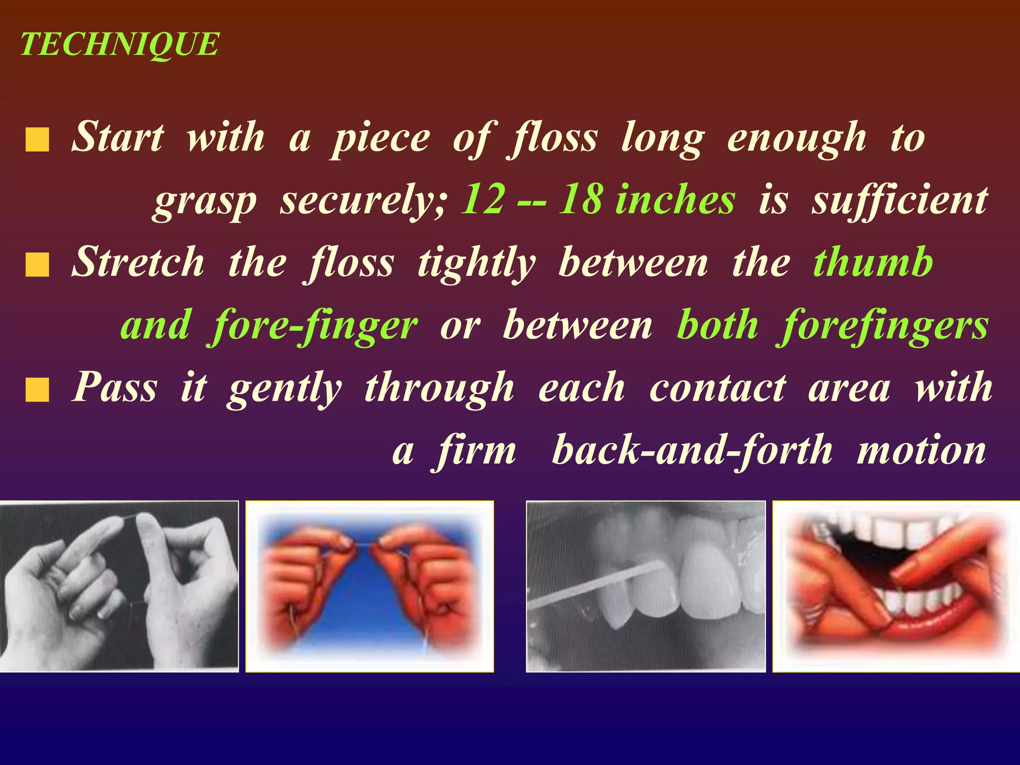 PLAQUE CONTROL.ppt