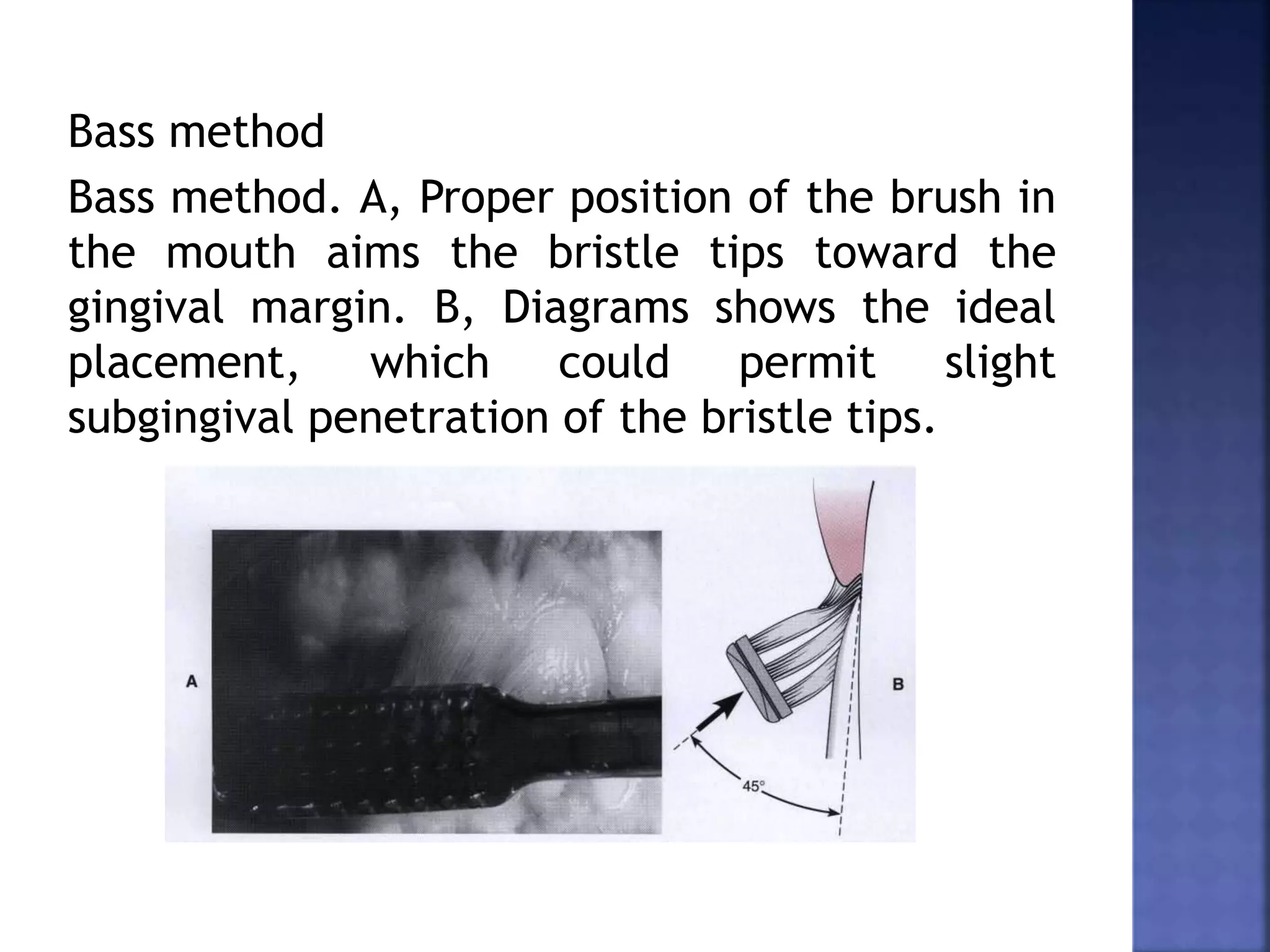 Plaque control.pptx