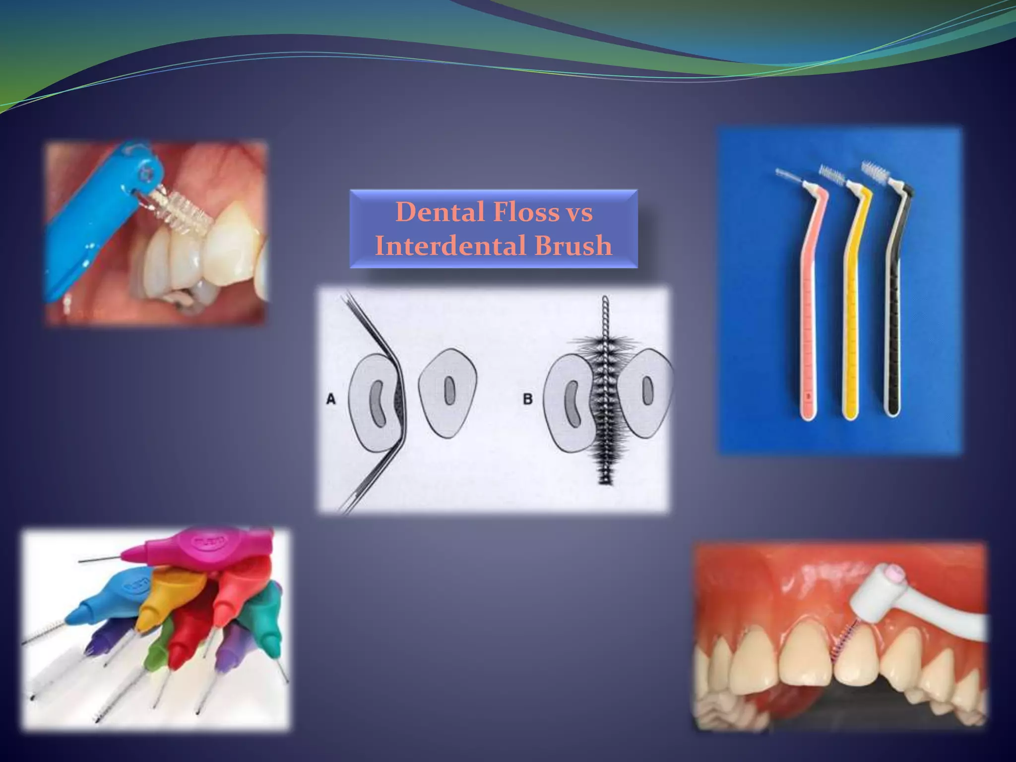 Plaque control for the periodontal patients | PPTX