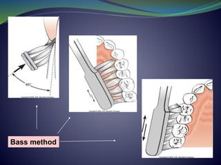 Plaque control for the periodontal patients | PPTX