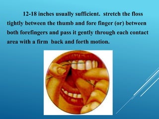 This presentation is on plaque control by various methods | PPT
