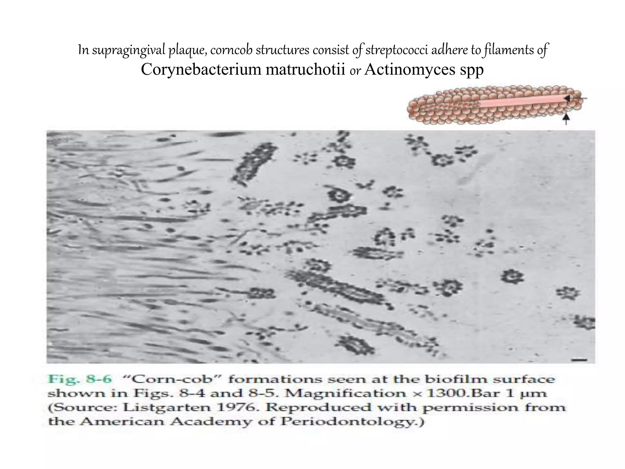 Plaque in health and disease | PPTX