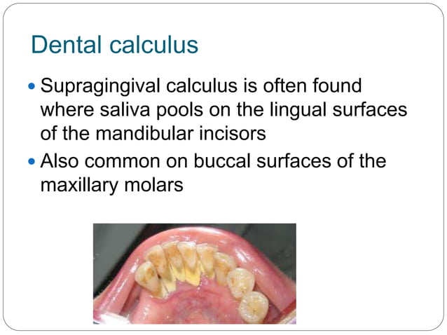 Plaque, Calculus, and Soft Deposits PowerPoint | PPTX | Dental Health ...
