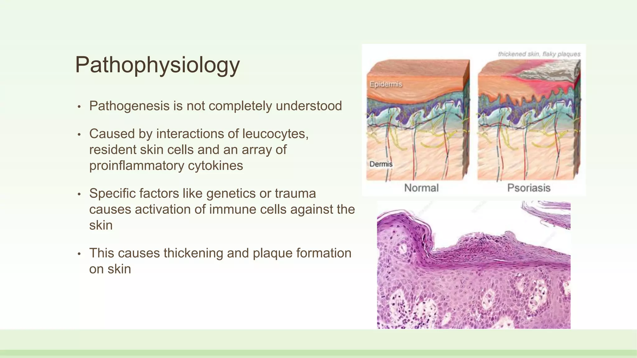 Plaque psoriasis presentation | PPTX