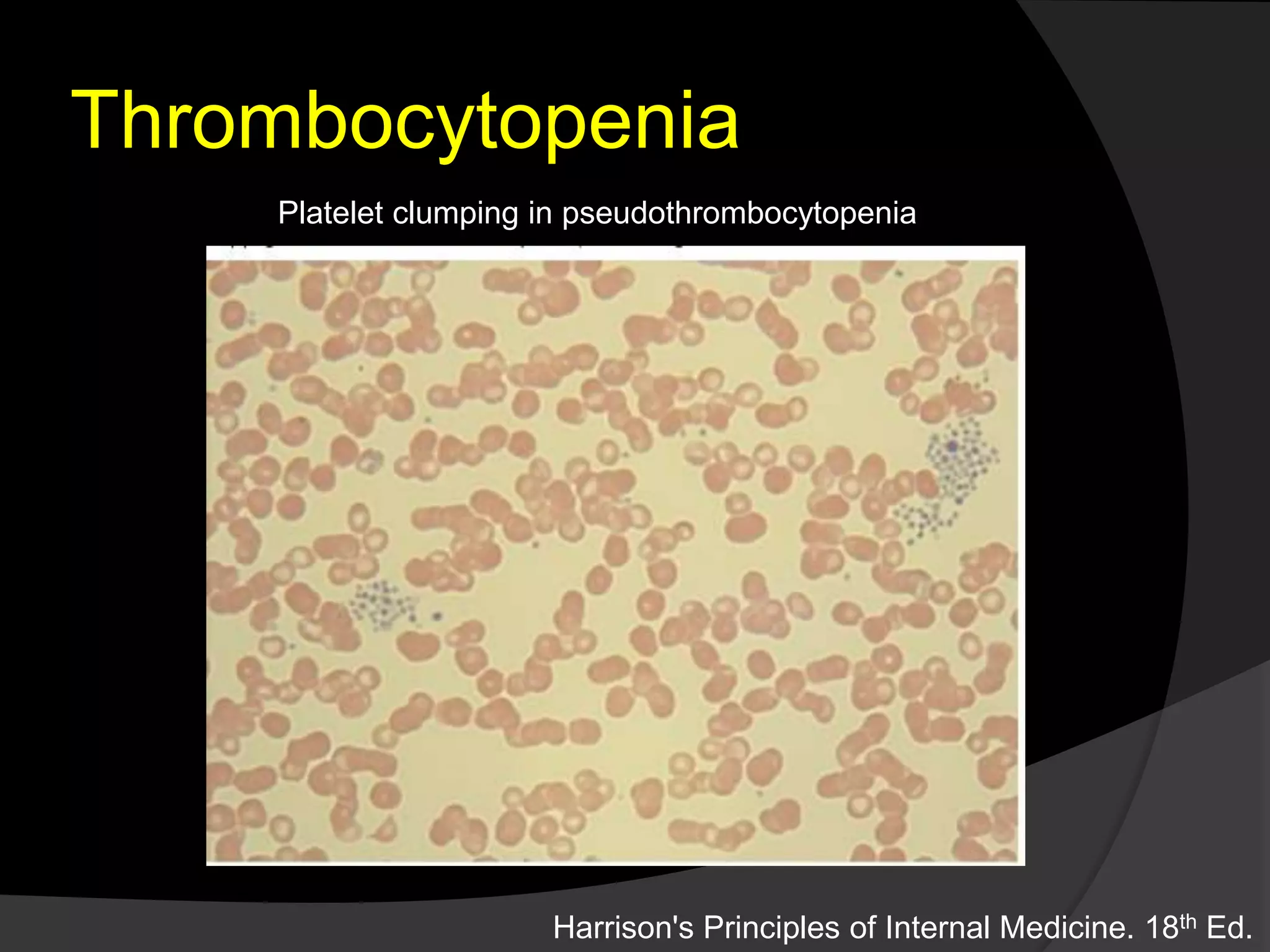 Disorders of Platelets | PPTX