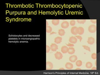 Disorders of Platelets | PPTX