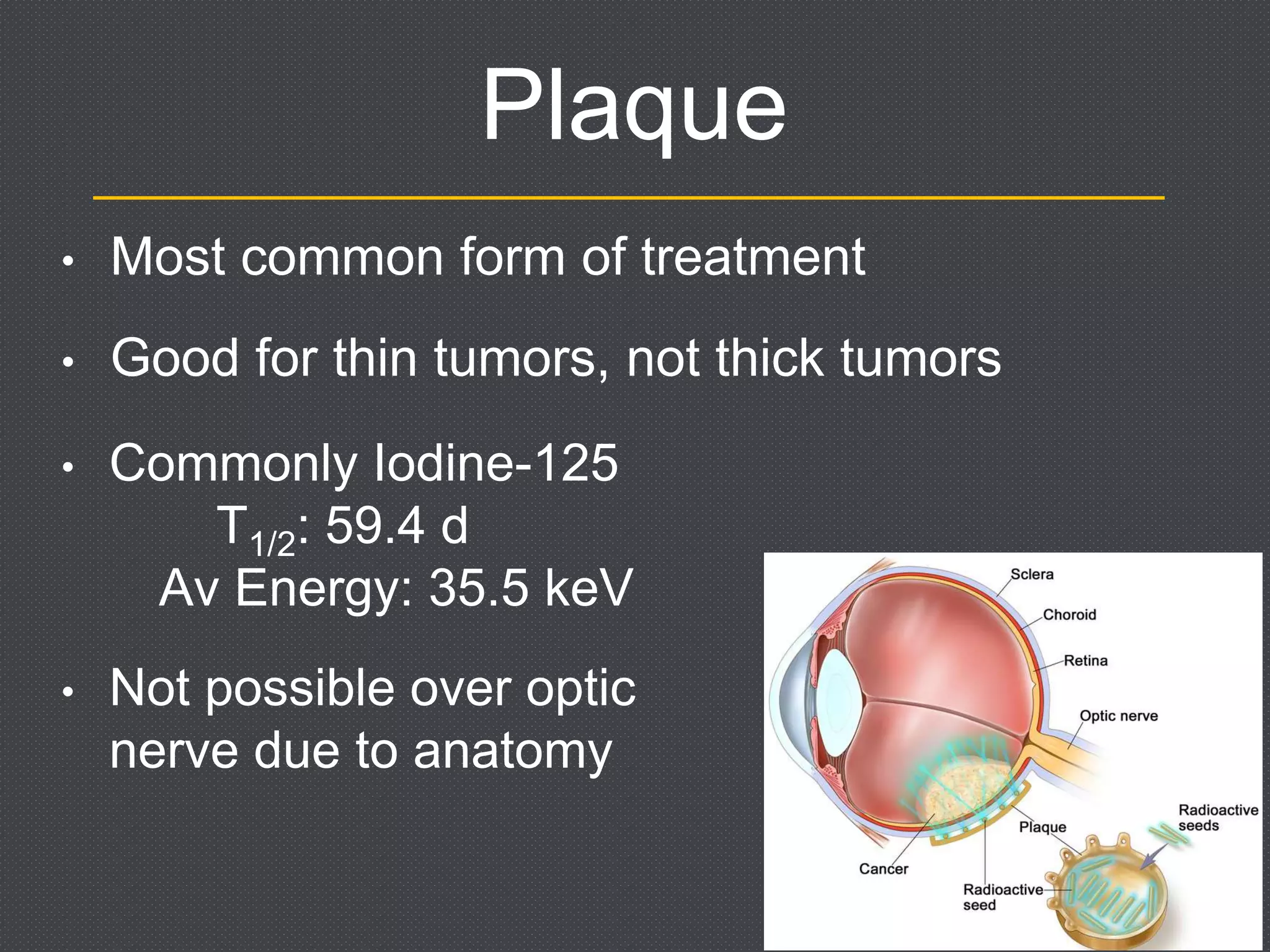 Plaque Radiotherapy for Uveal Melanoma | PPTX