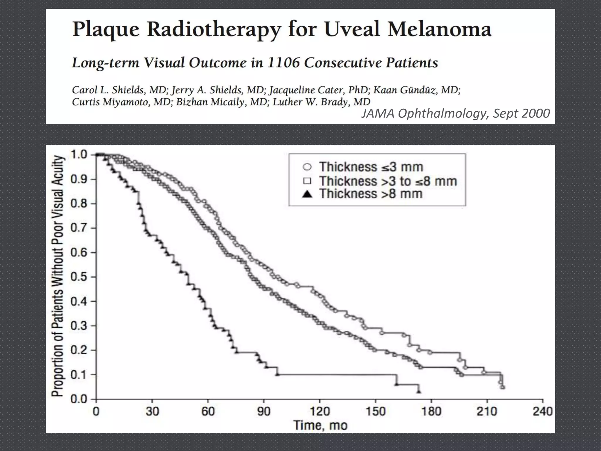 Plaque Radiotherapy for Uveal Melanoma | PPTX