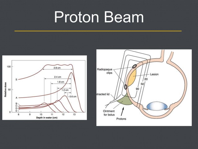 Plaque Radiotherapy for Uveal Melanoma | PPTX