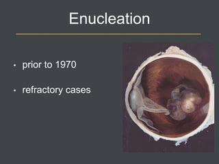 Plaque Radiotherapy for Uveal Melanoma | PPTX