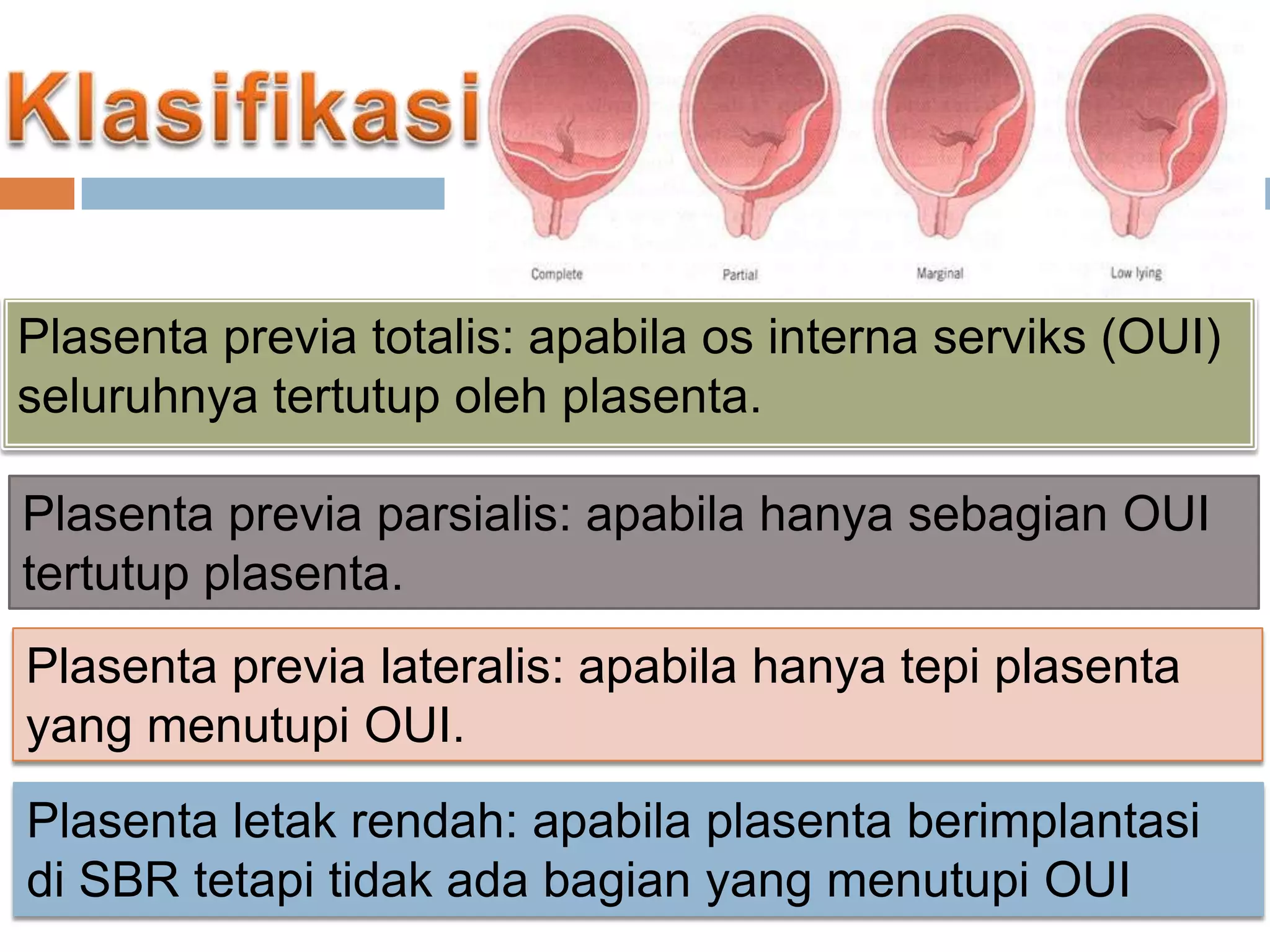 Plasenta previa | PPTX