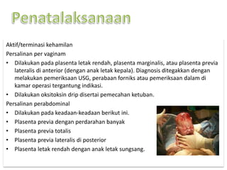 Plasenta previa (2) | PPTX