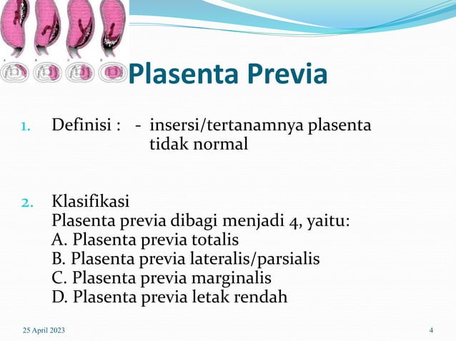 Plasenta_Previa_and_Sol_Plasenta idri.pptx