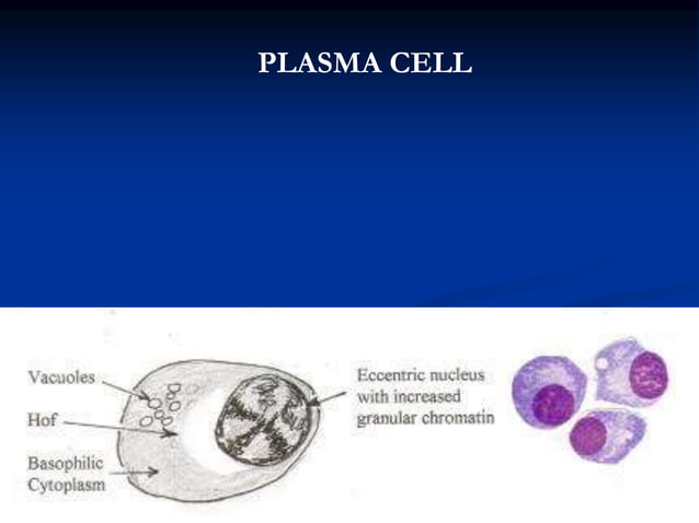 Plasma cell disorders | PPTX
